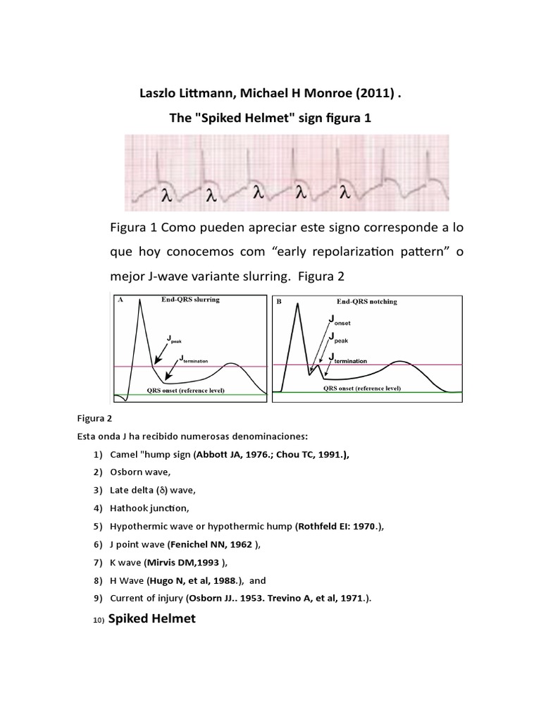 The Spiked Helmet Sign and J Wave Relatinship | PDF
