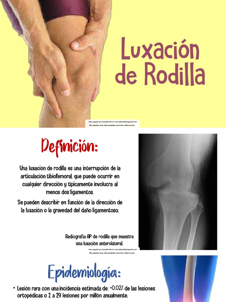 Luxacion de Rodilla 145123 Downloadable 628310 | PDF | Sistema ...