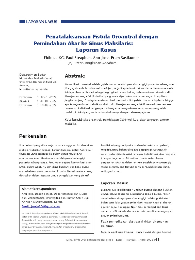 OroantralFistula Finish | PDF