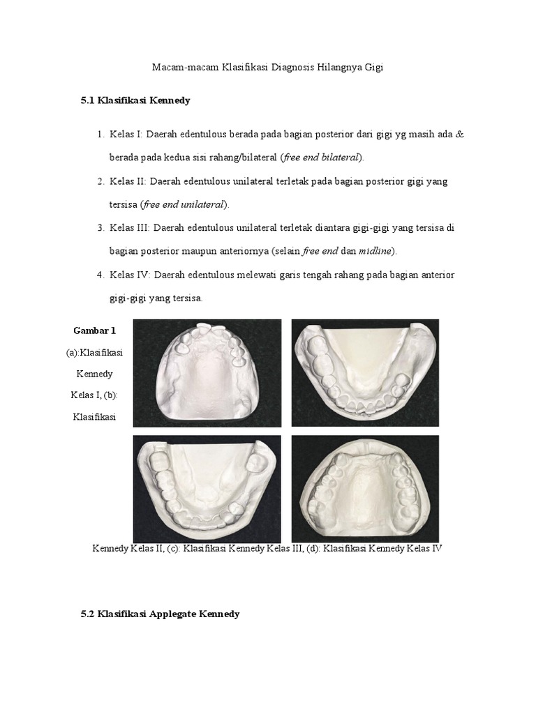 Macam-Macam Klasifikasi Diagnosis Hilangnya Gigi | PDF