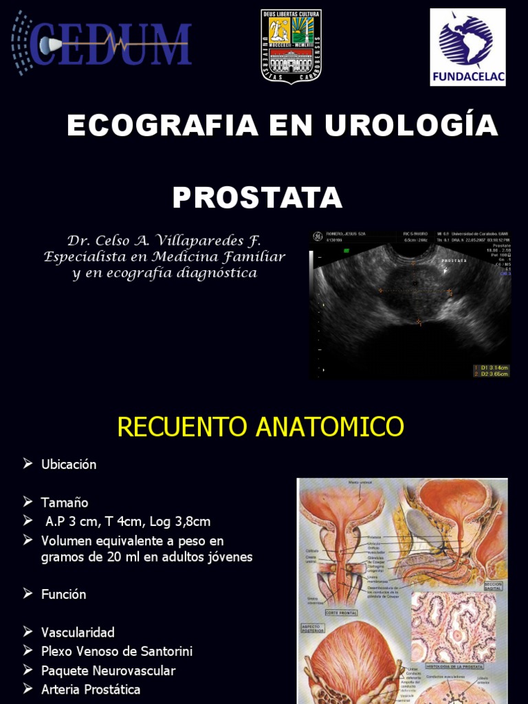 Prostata | PDF | Próstata | Ultrasonido médico