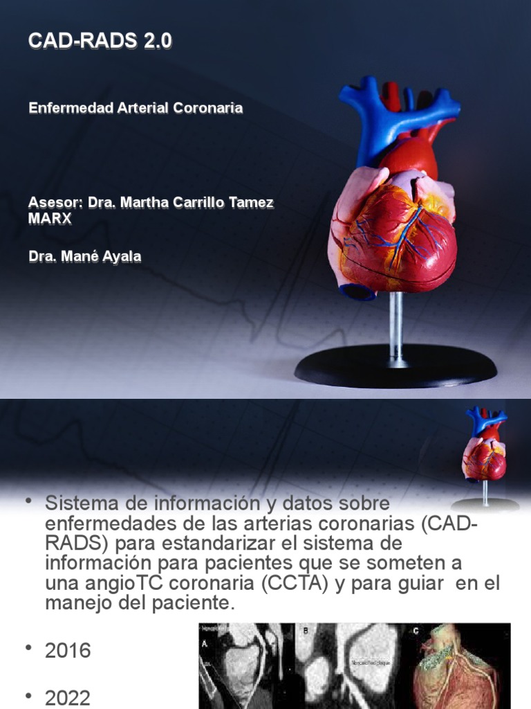 Cad-Rads 2 | PDF | Infarto de miocardio | Isquemia