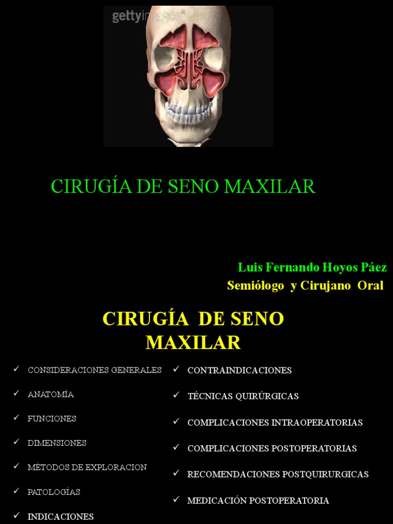 Técnicas Quirúrgicas del Seno Maxilar | PDF | Anatomía humana | Cabeza ...