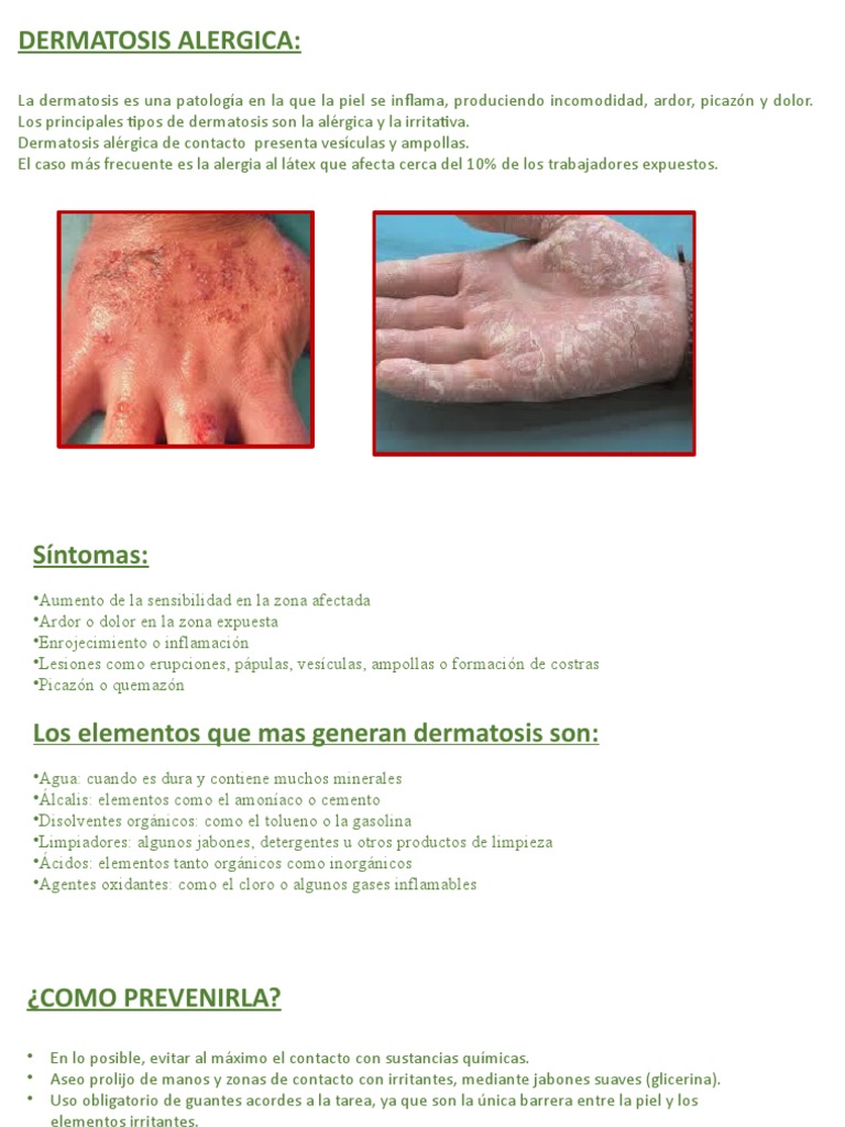 Dermatosis Profesional: Prevención y Tratamiento | PDF