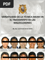 Arco Transpalatino ATP | PDF | Ramas de Odontología