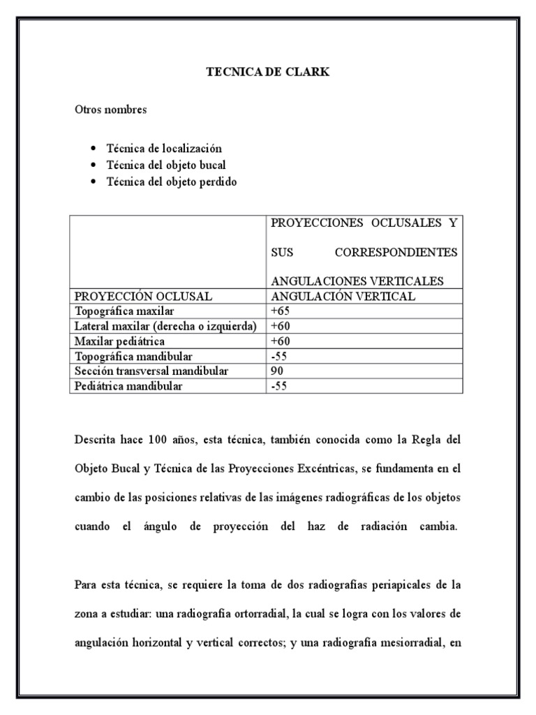 Tecnica de Clark | Descargar gratis PDF | Rayo X | Diente