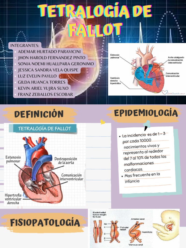 Posición en Cuclillas en Tetralogía de Fallot | PDF | Ventrículo ...