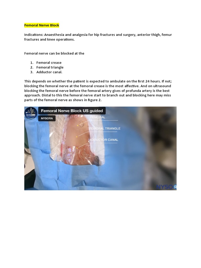 Femoral Nerve Block | PDF | Science & Mathematics