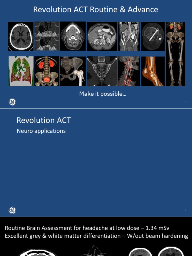 Revolution ACT Clinical Image Gallery | Download Free PDF | Ct Scan ...