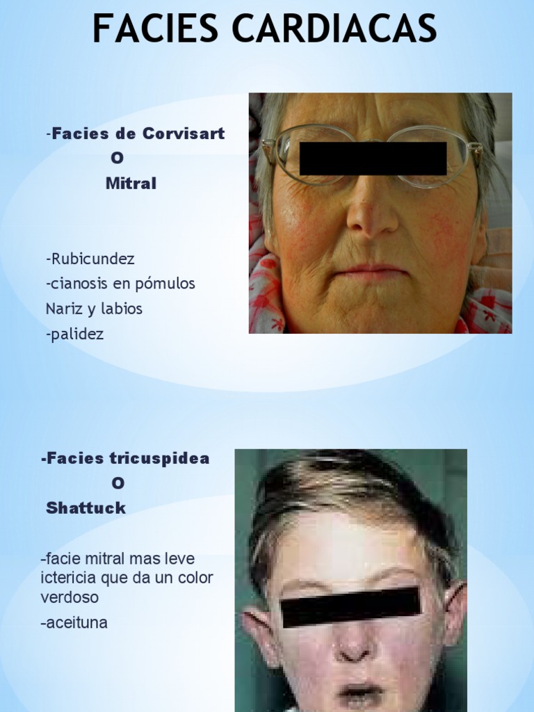 Facies Cardiacas | PDF