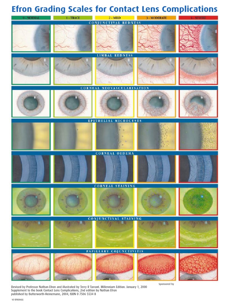 Efron_Grading_Scales_for_Contact_Lens_Co | PDF