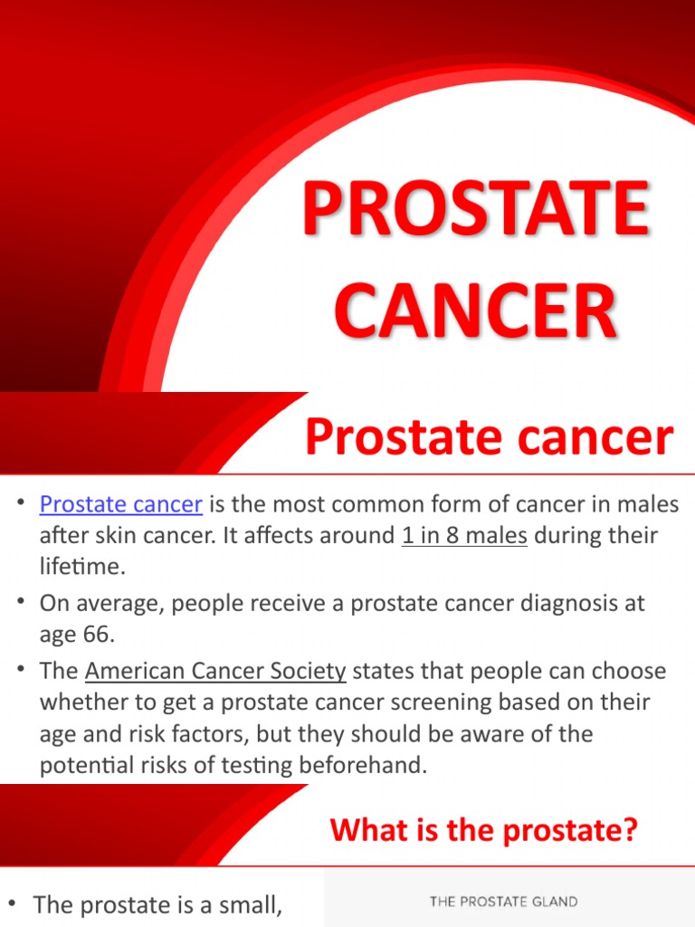 Prostate Cancer Power Point | PDF | Prostate | Urination