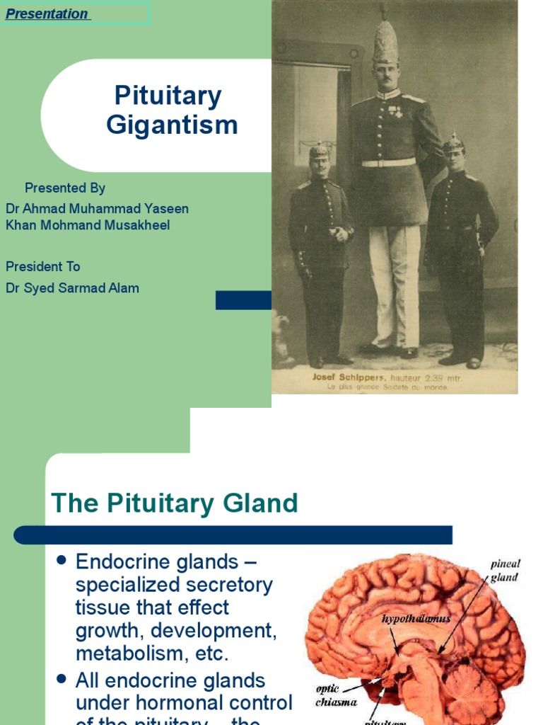 Gigantism Presentation | PDF | Growth Hormone | Pituitary Gland