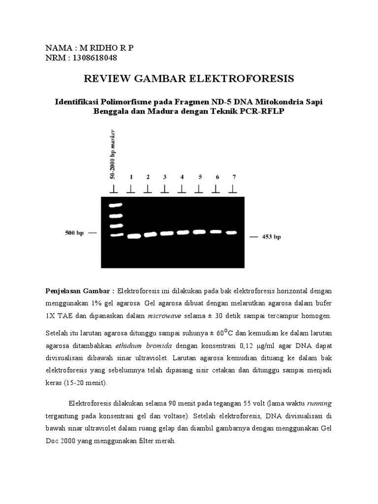 M Ridho R P - 1308618048 - Review Gambar Elektroforesis | PDF