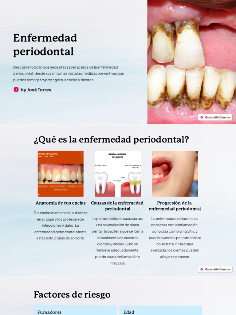 Enfermedad Periodontal22 | PDF | Especialidades Medicas | Salud pública