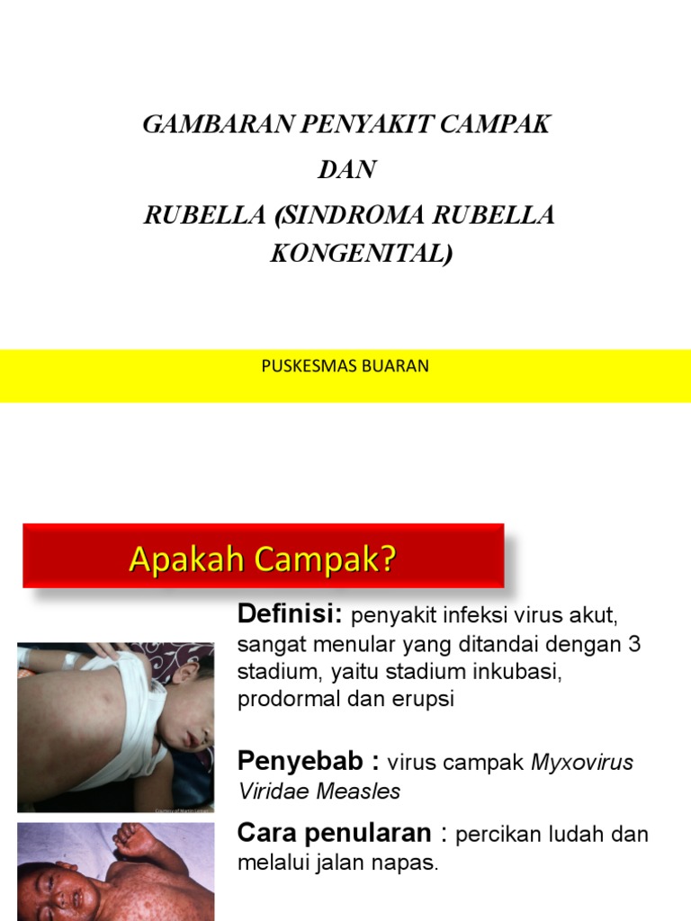 CAMPAK-RUBELLA | PDF
