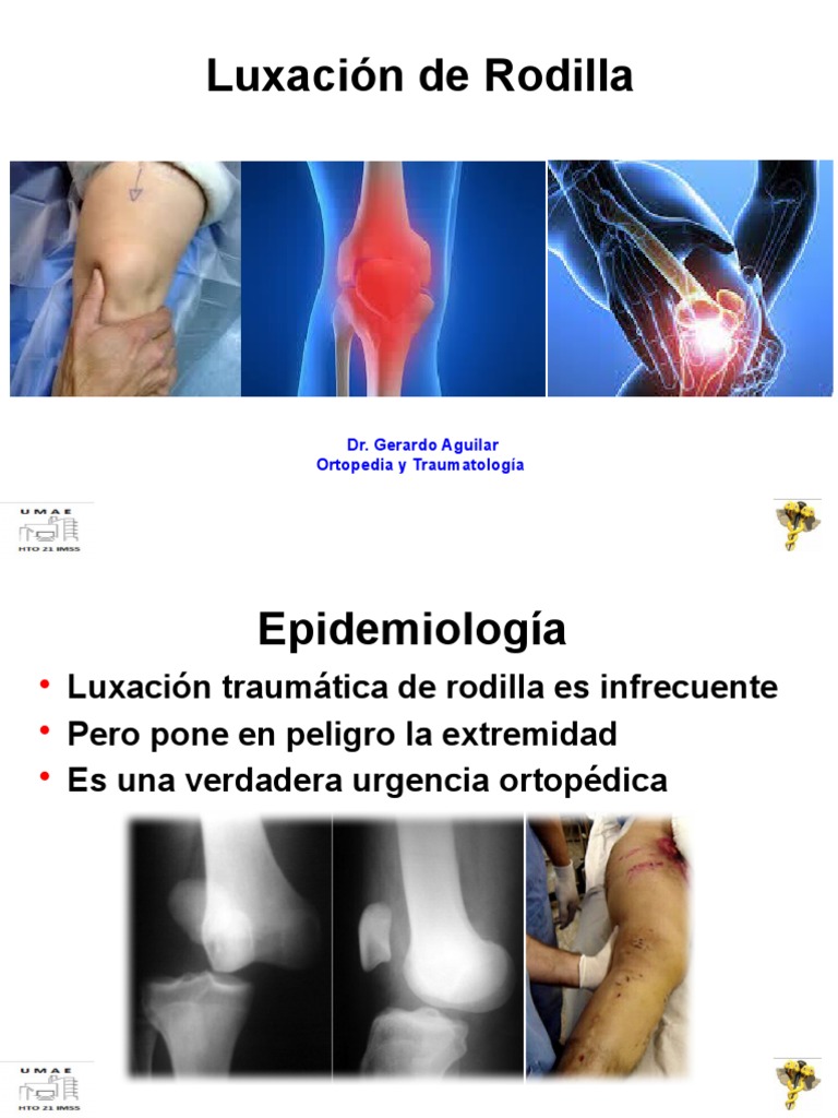 Luxación de Rodilla-Dr Gerardo | PDF | Rodilla | Medicina CLINICA