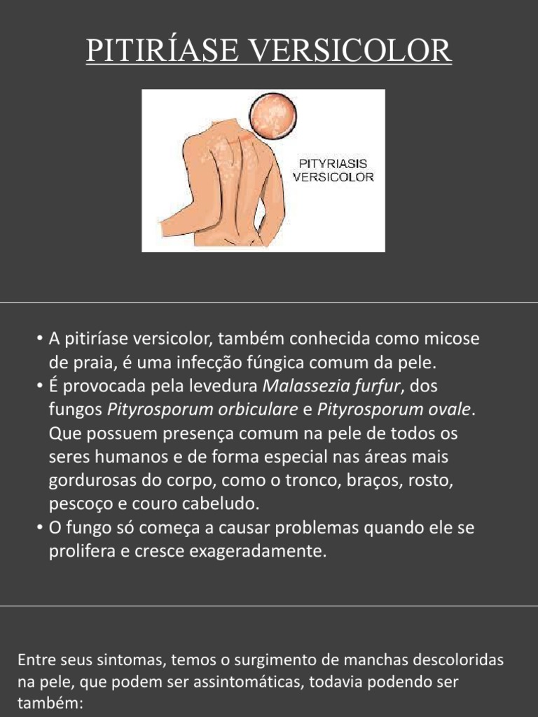 Pitiríase Versicolor | PDF | Bem-estar