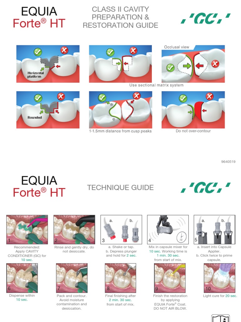 Equia Forte Ht Technique Guide | PDF