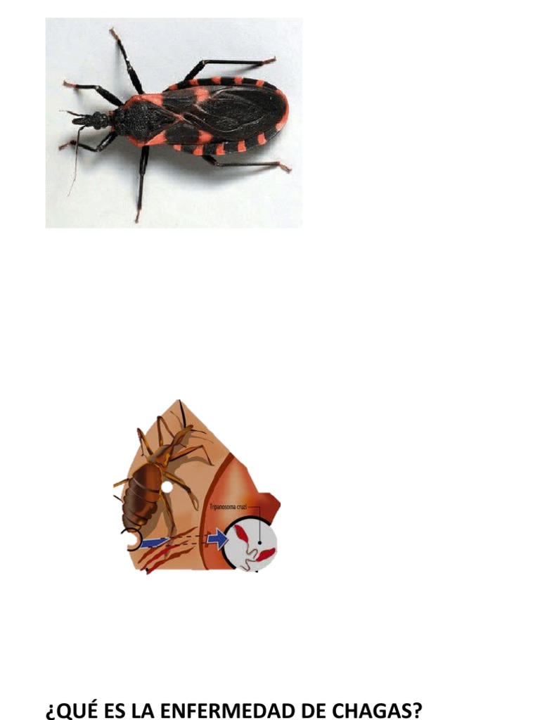 Enfermedad de Chagas: Síntomas y Prevención | PDF | Ciencias de la ...