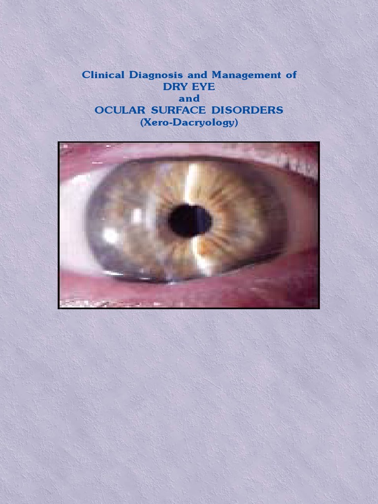 Clinical Diagnosis and Management of Dry Eye and Ocular Surface | PDF | Cornea | Magnesium