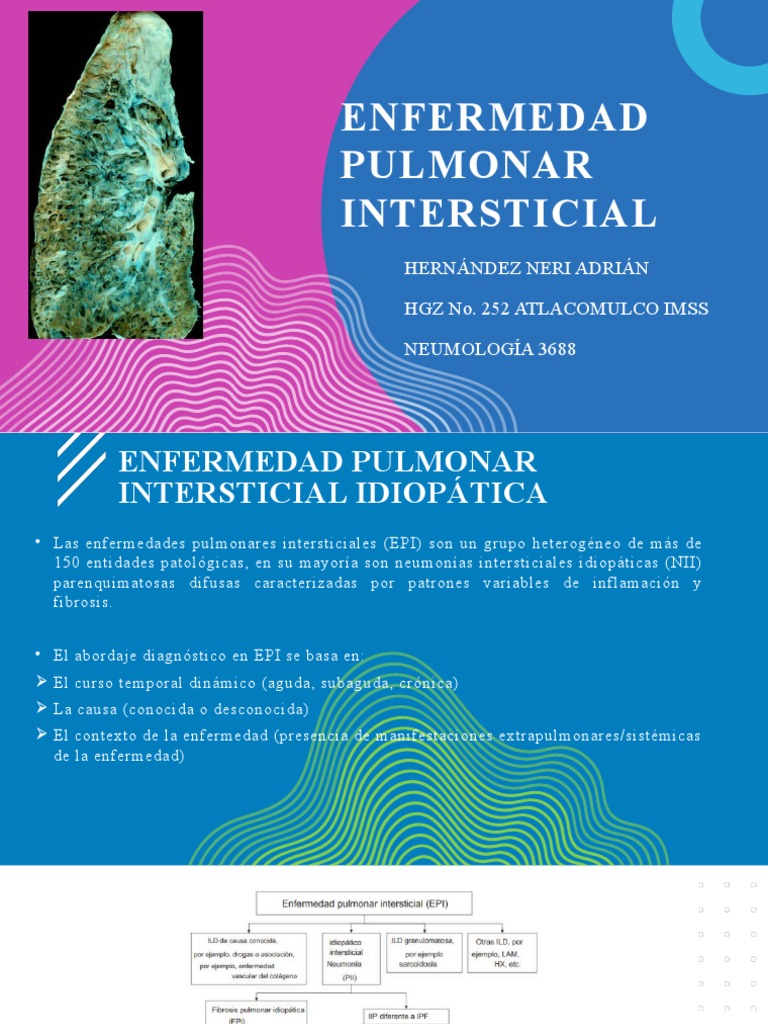 Enfermedad Pulmonar Intersticial | PDF