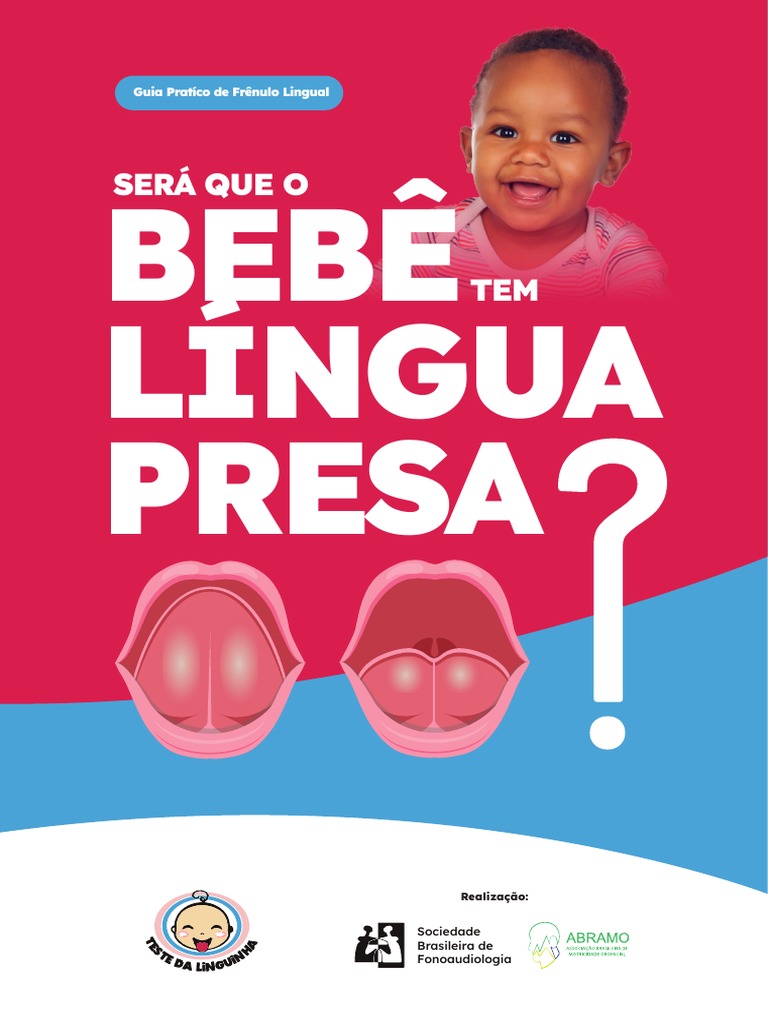 Guia Pratico de Frenulo Lingual | PDF | Ciências da Saúde