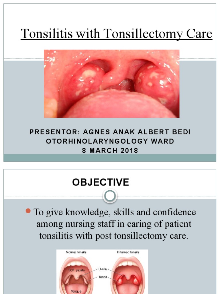 Tonsillectomy (Autosaved) | PDF | Medical Specialties | Clinical Medicine