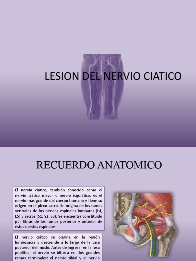 Lesiones del Nervio Ciático: Causas y Tratamiento | PDF | Neuroanatomía ...