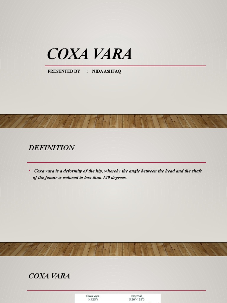 Coxa Vara | PDF