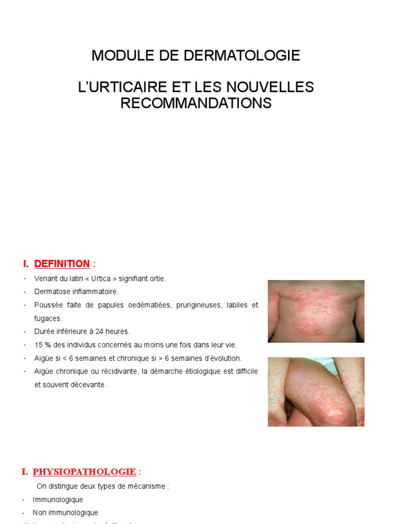 Dermato6an-Urticaire Chronique2020boussaid | PDF | Bien-être | Sciences ...