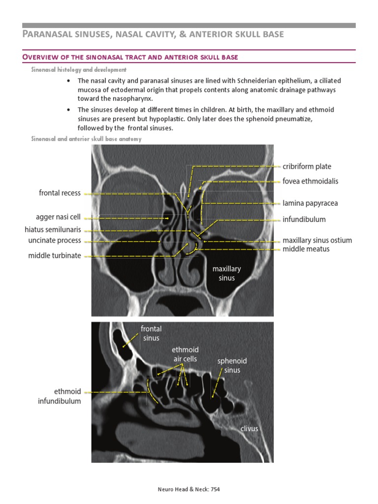 Core Radiology - Head & Neck Imaging | PDF | Human Nose | Human Head ...