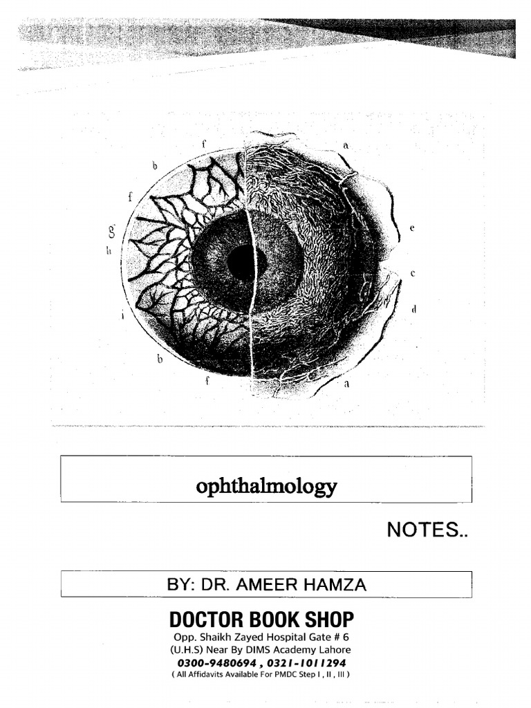 Ophthalmology Handwritten Notes | PDF