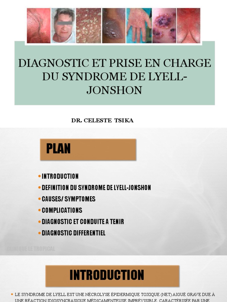 Presentation Syndrome de Lyell | PDF | Épidémiologie | Sciences de la santé