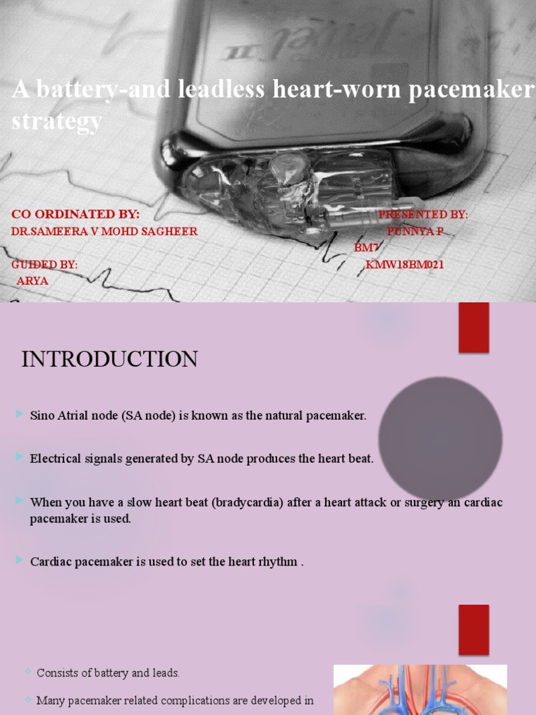 A Battery-And Leadless Heart-Worn Pacemaker Strategy | PDF