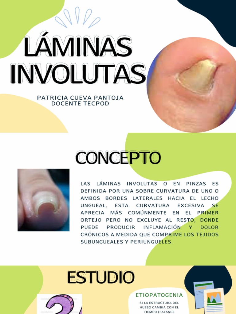 Láminas Involutas Conv | PDF