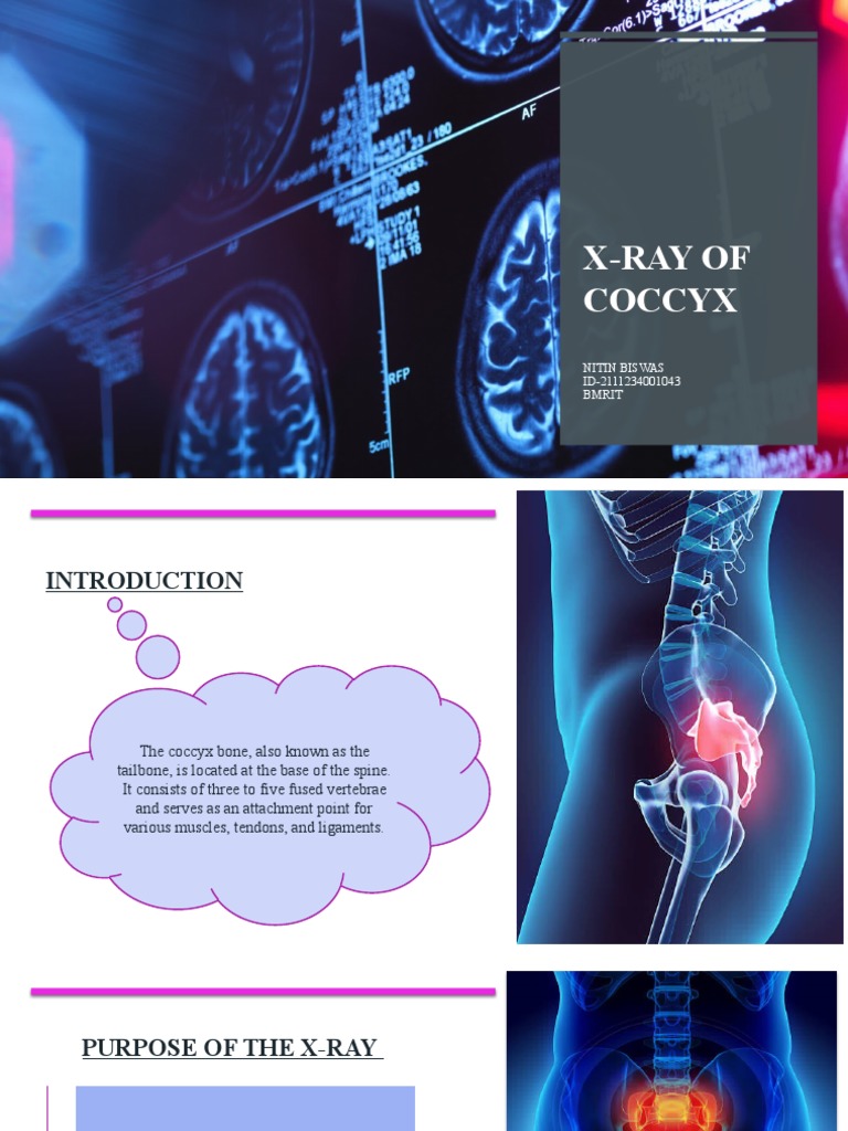 Coccyx | PDF