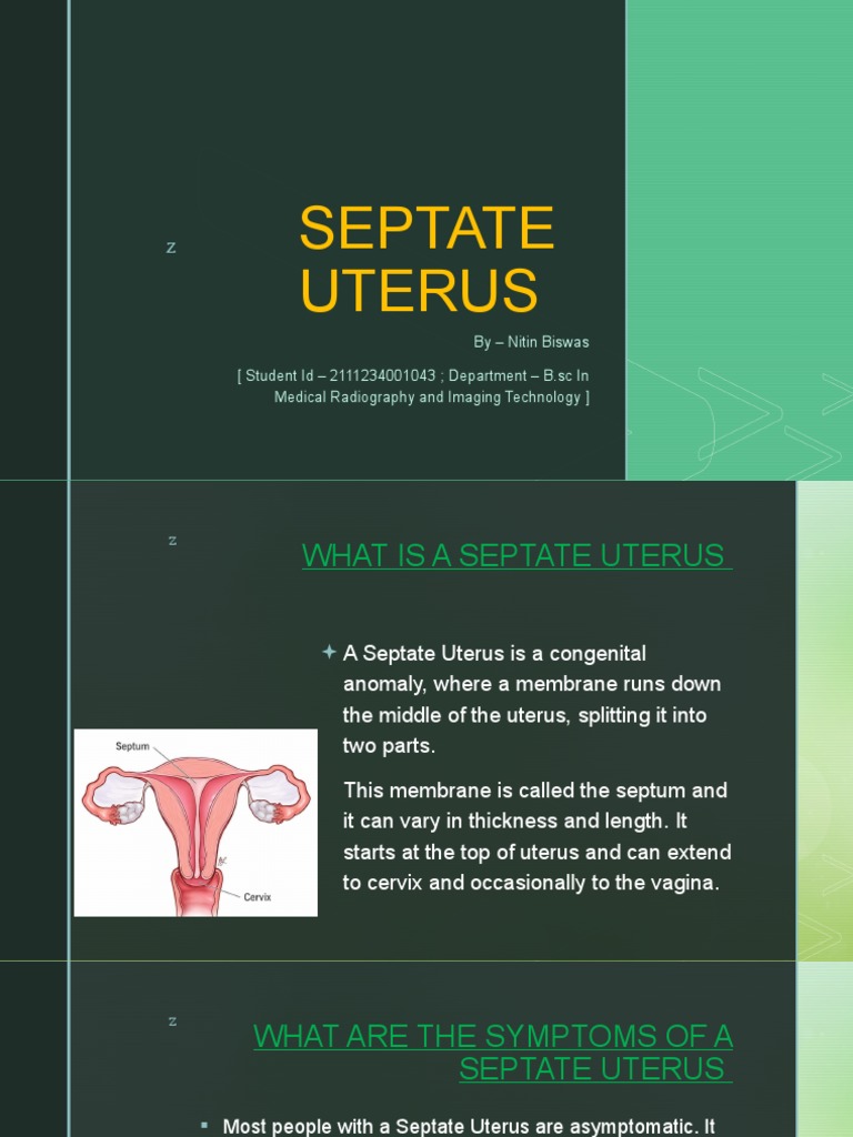 Septate Uterus | PDF | Wellness