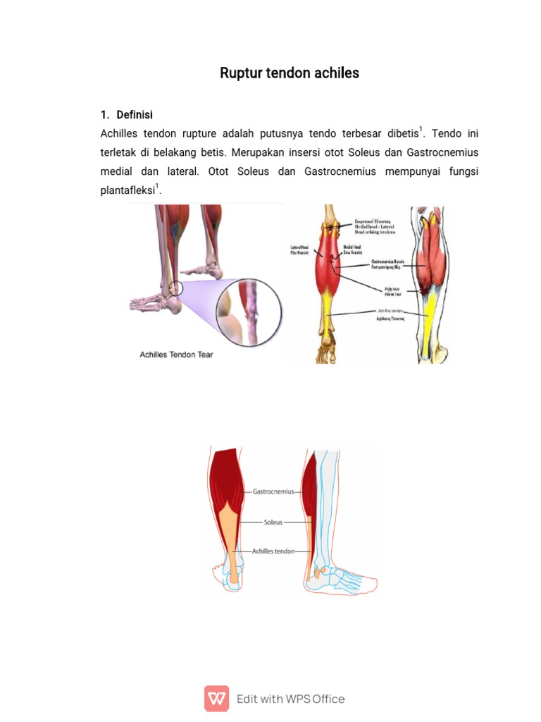 Ruptur Tendon | PDF