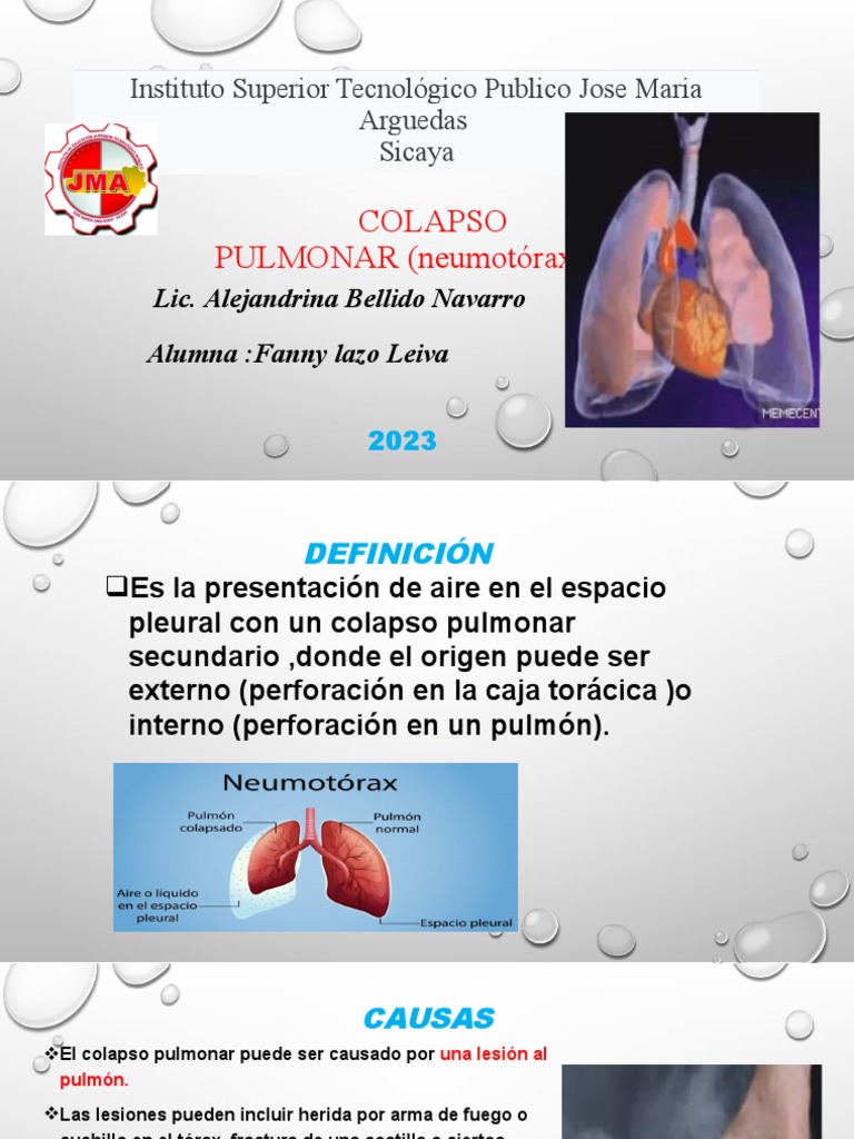 Colapso Pulmonar - 063651 | PDF