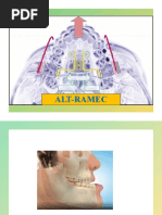 MBT Bracket Prescription | PDF | Orthodontics | Tooth