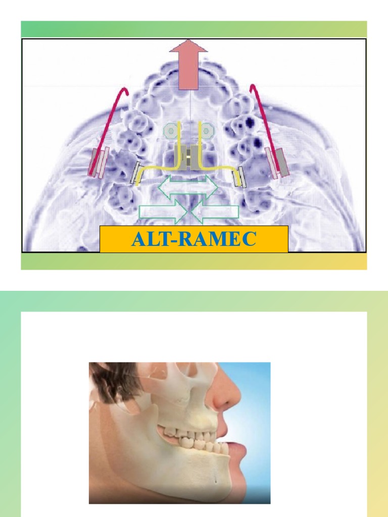 Alt Ramec | PDF