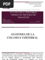 Anomalías de Transición Lumbosacra Por Tc. Método Castellvi | PDF | Vértebra | Sistema ...