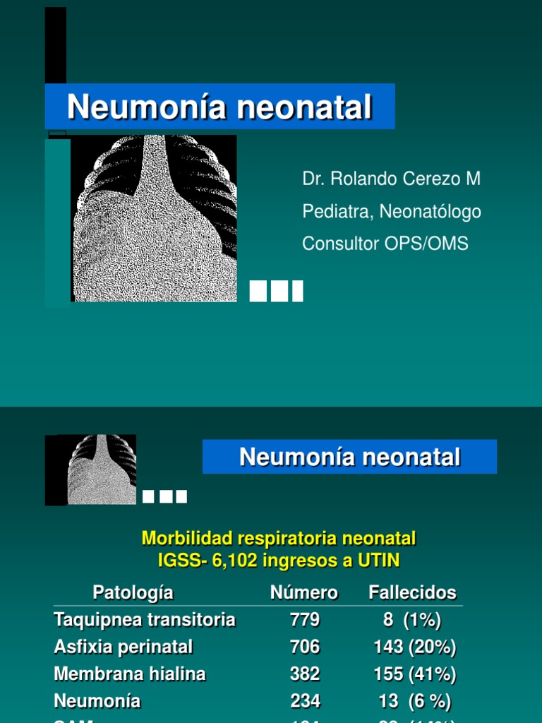 Neumonia Neonatal | PDF | Neumonía | Placenta