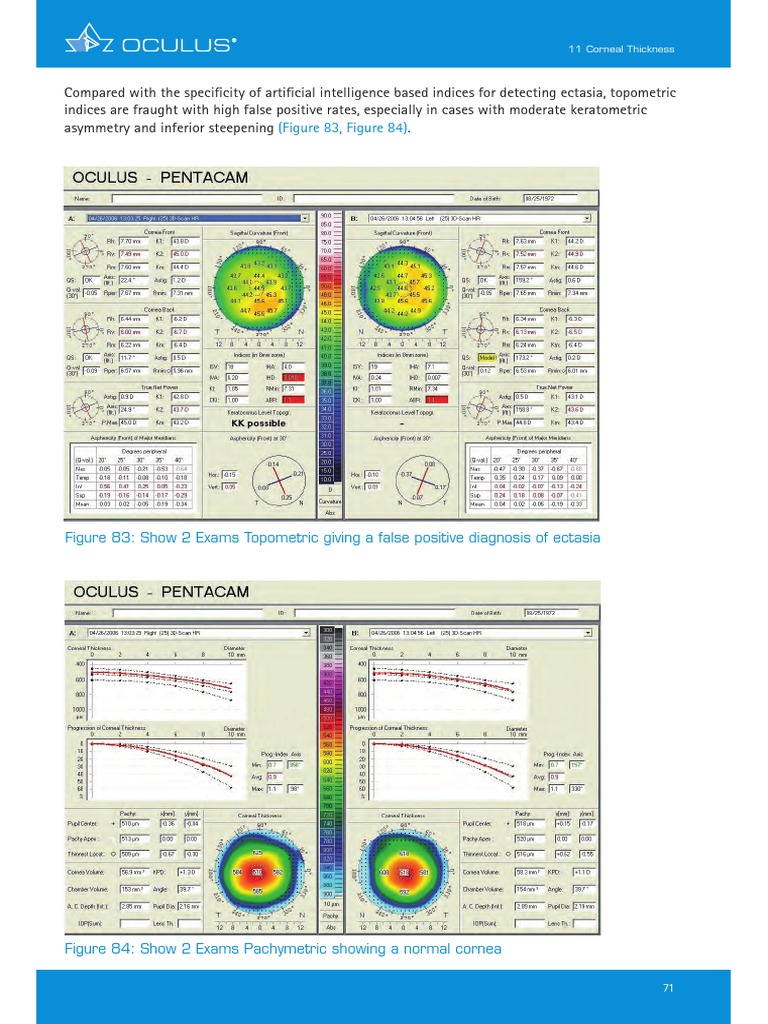 OCULUS使用说明书 英文 - 73-144 | PDF | Cornea | Glaucoma