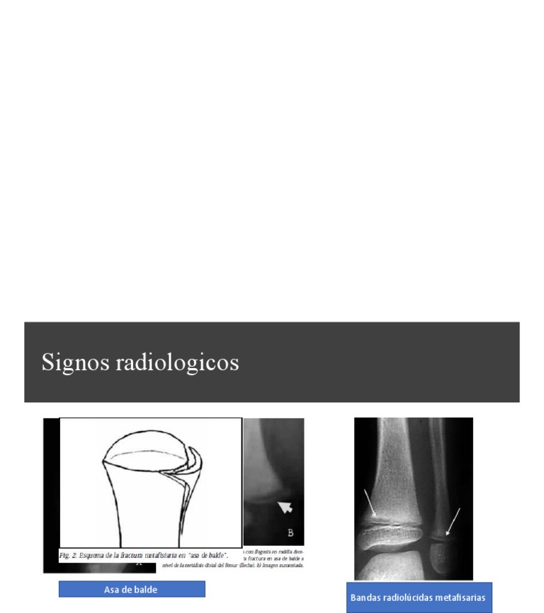 Signos Radiologicos | PDF