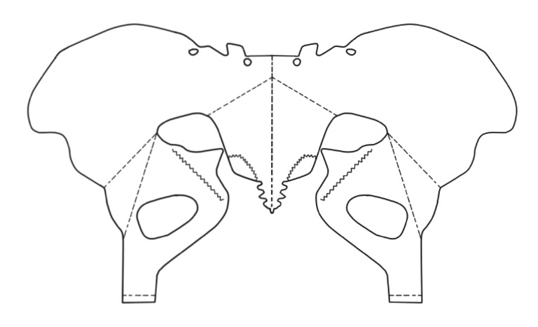 Pelvis Modelo Papercraft | PDF