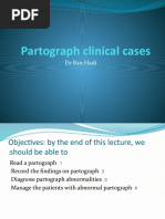 Partogram | PDF | Childbirth | Human Pregnancy