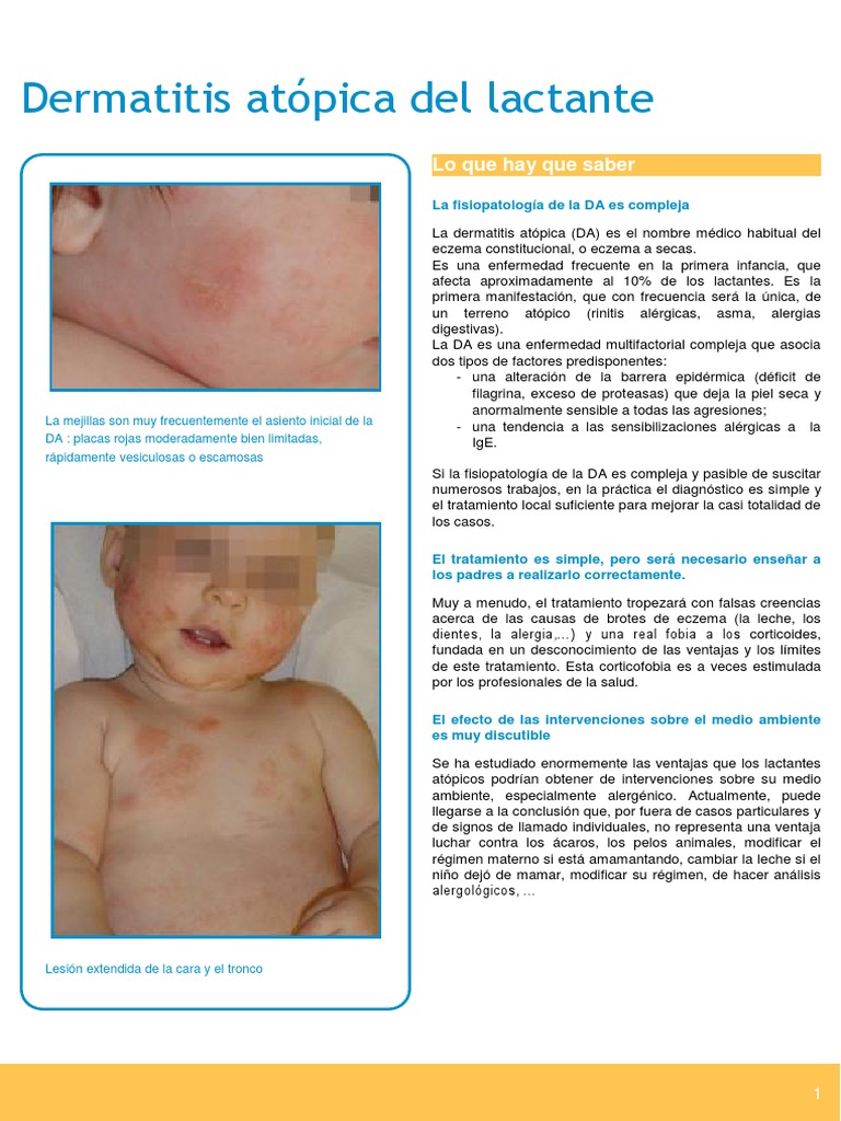03-Dermatitis Atópica | PDF | Alergia | Ciencias de la Salud