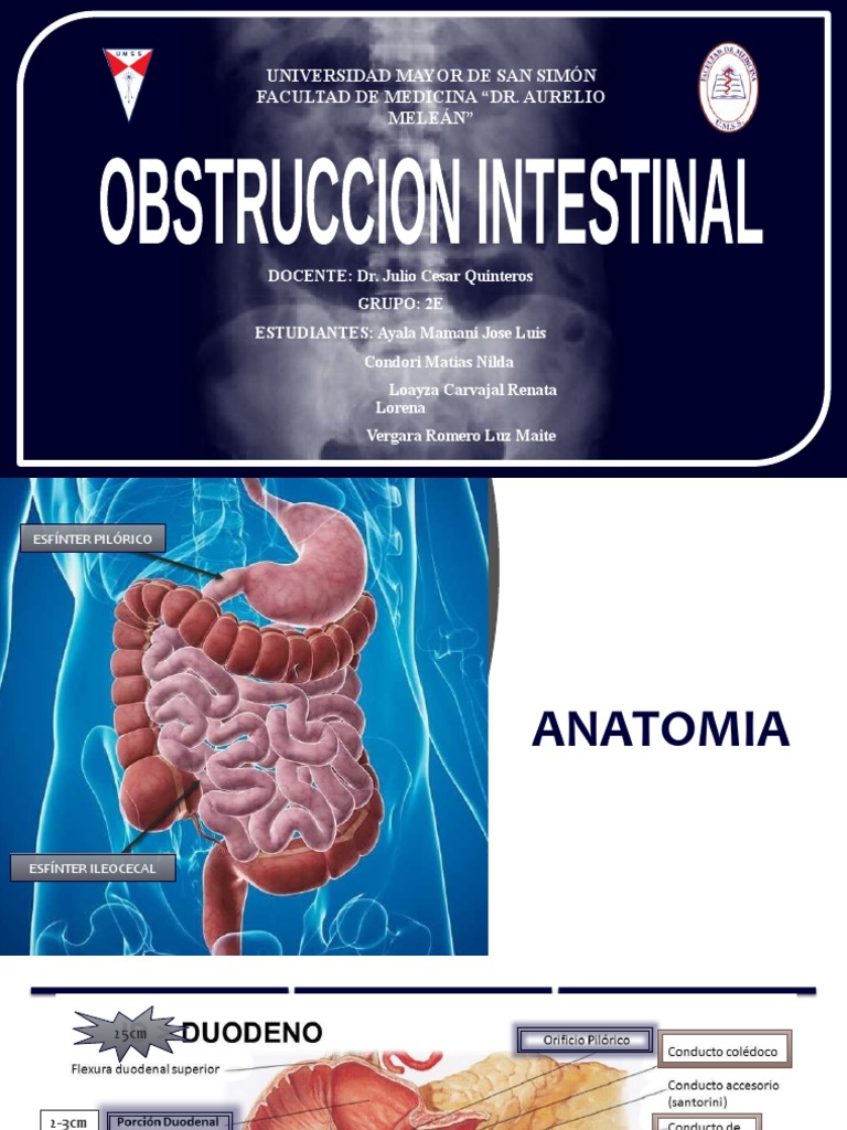 Obstrucción Intestinal: Causas y Tratamiento | PDF | Intestino grueso ...